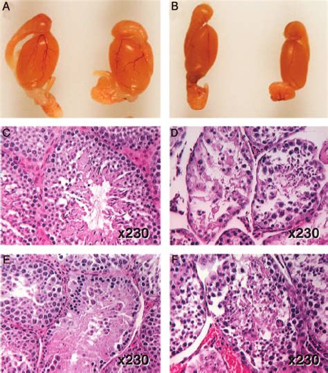 Evidence Of Defects In Spermatogenesis In Testes From Mice With