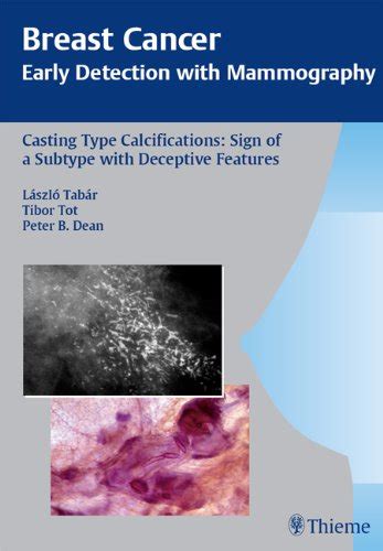casting type calcifications sign of a subtype with deceptive features