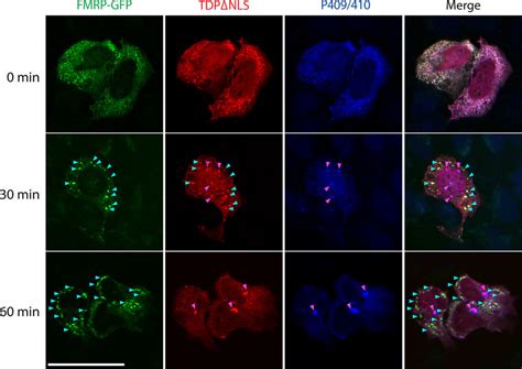 Tdp 43 Aggregates Undergo A Dynamic Transition From Cytoplasmic