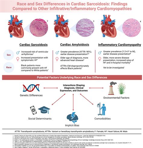 Exploring Race And Sex Differences In Cardiac Sarcoidosis “dispare” No