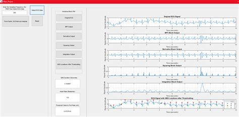 Qrs Detection Using Pan Tompkins Algorithm From Ecg Signal File