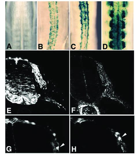 Adenovirus Mediated Exogenous Protein Expression In Neural Crest Cells