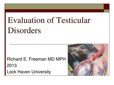 Ppt Evaluation Of Testicular Disorders Powerpoint Presentation Free
