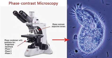 Phase Contrast Microscopy Definition Principle Parts Uses