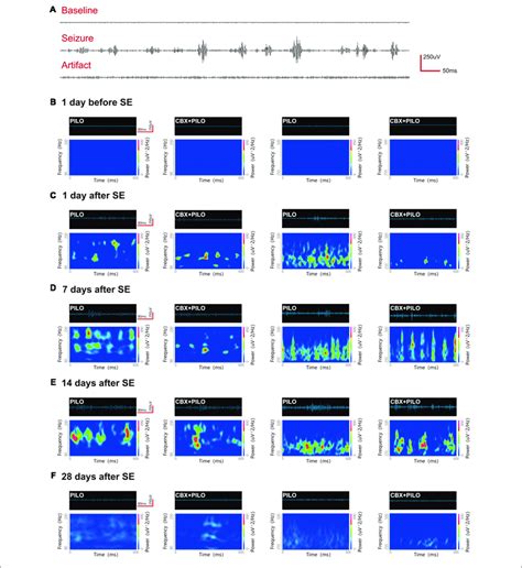 Waveforms And Spectrograms Features Of Lithium Pilocarpine Induced