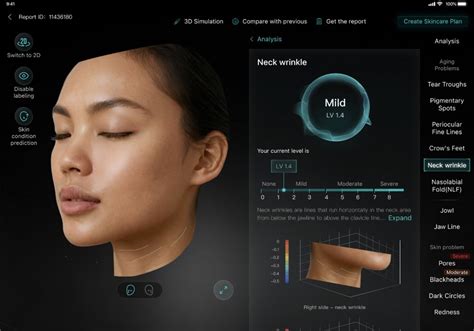 Evelab Insight Unveils Advanced Neck Analysis With Revolutionary