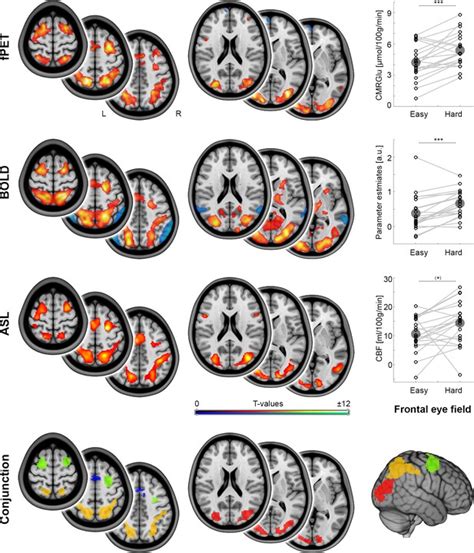 Figures And Data In Reconfiguration Of Functional Brain Networks And