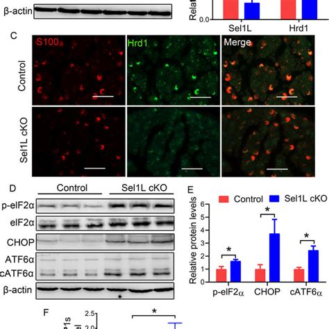 Sel1l Deficiency Led To Elimination Of Hrd1 And Activation Of The Upr