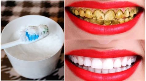 How To Whiten Teeth Prevent Bad Breath Tartar And Plaque Using This