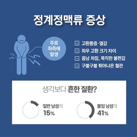 남성불임 정자활동성 낮추는 정계정맥류…초음파로 체크하세요 네이트 뉴스