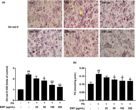Effect Of Emt On Lipid Accumulation In Pa‐induced Hepg2 Cells A Oil