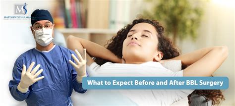 Before And After Bbl Surgery Matthew Schulman M D