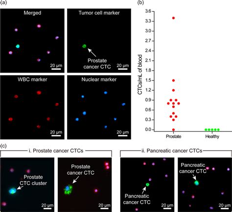 Isolation Of Circulating Tumor Cells From Clinical Samples A
