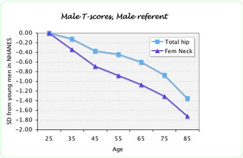 Female Bone Density Chart A Visual Reference Of Charts Chart Master