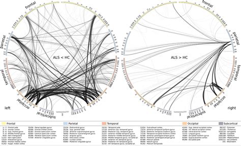 Between Group Differences In Connectivity Connectograms Als Related