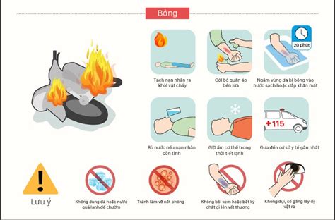 Các Bước Sơ Cứu Khi Bị Bỏng