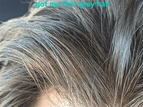 Got My First Gray Hair 36 Years Old R Malehairadvice