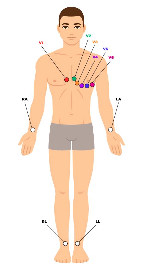 12 Lead Ecg Placement Guide Cardiacdirect