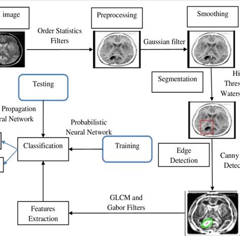 Brain Tumor Detection Based On Pnn Training Process With Bpnn