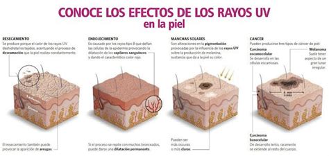 El Efecto De Los Rayos Uv En Nuestra Piel