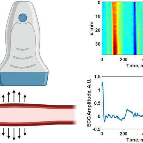 Pulse Wave Imaging Pwi As The Pulse Travels From Left To Right X
