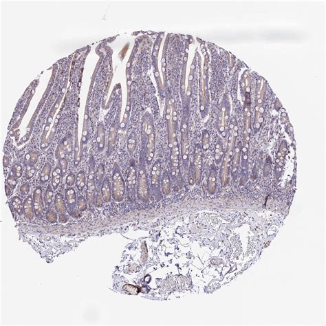 Tissue Expression Of Cdc37l1 Staining In Duodenum The Human Protein