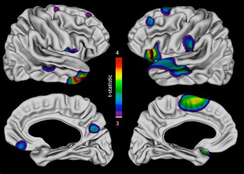 prenatal growth in humans and postnatal brain maturation into late