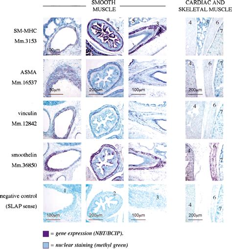 Prediction Of Cell Type Specific Gene Modules Identification And