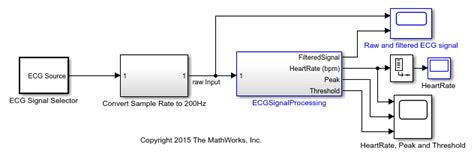 real time ecg qrs detection on arm cortex m processor matlab