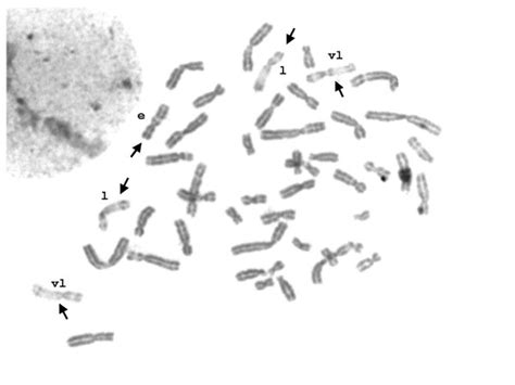 Metaphase Of Brdu Pulsed Culture Arrows Point To X Chromosomes Showing