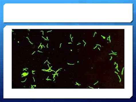 Lab Diagnosis Of Syphilis