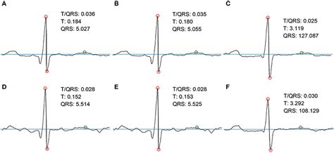 Frontiers Comparative Effectiveness Of Ica And Pca In Extraction Of