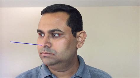 how to understand head pose estimation angles in python