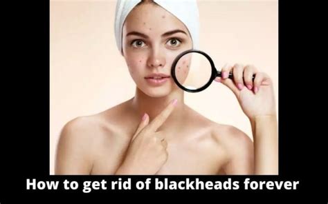 How To Get Rid Of Blackheads Forever Blackheads Ventuneac