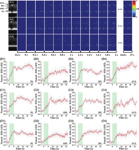 Spatiotemporal Characterization Of Neural Ioss A Enlarged