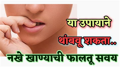 काही केल्या नखं चावण्याची फालतू सवय जात नाही मग हे उपाय कराच