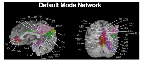The Core Of The Default Mode Network Dmn While A Multi Lobar