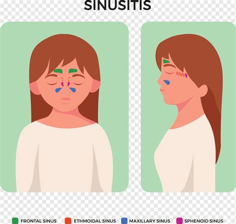 Sinusitis Enfermedad Sinus Anatomy Ilustración Png Pngwing