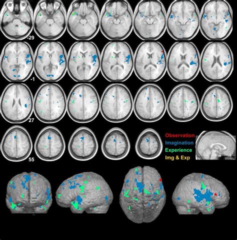 Ppi Maps Of The Whole Brain Functional Connectivity Of The Whole Brain