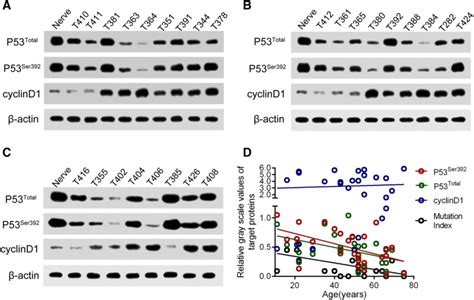 Expression And Phosphorylation Status Of P53 Protein In Schwannomas