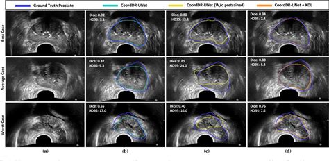 Figure 9 From Domain Generalization For Prostate Segmentation In