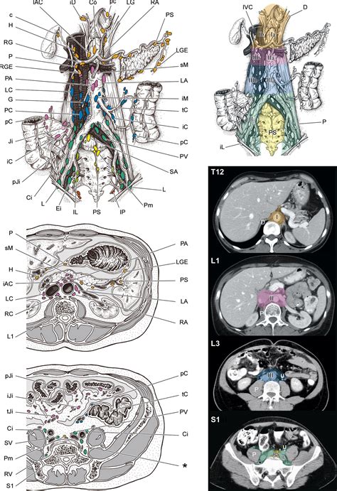 Anatomical Bases For The Radiological Delineation Of Lymph Node Areas