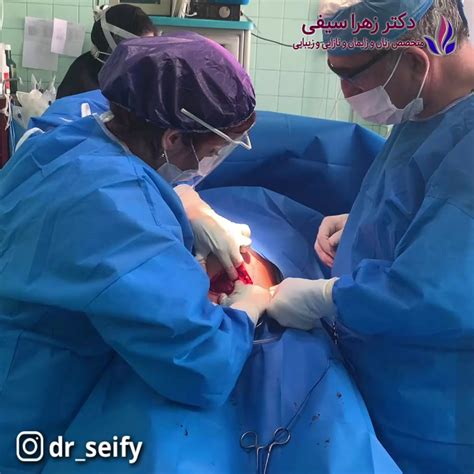 سزارین کاملا بدون درد با پمپ بی دردی دکتر زهرا سیفی