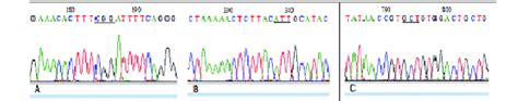 The Sequence Results Of Chek2 Sequence Electropherogram Showing The