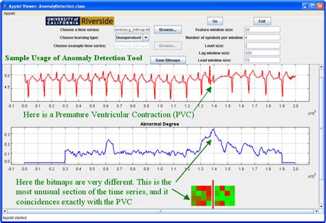anomaly detection applet