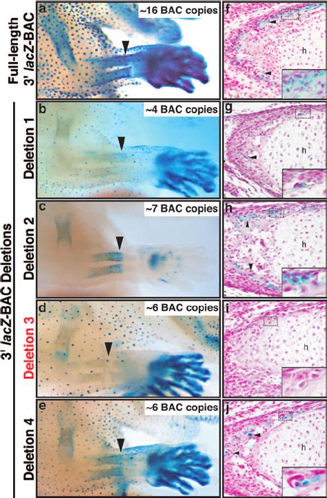 Numerous Cis Regulatory Sequences Are Dispersed Throughout The Distant