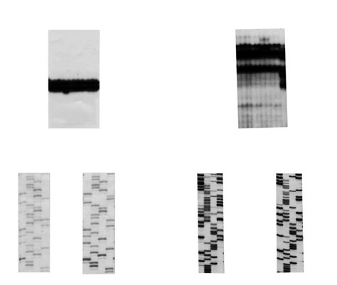 A B Representative Examples Of Polymerase Chain Reaction Single Strand