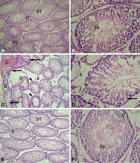 Hematoxylin And Eosin Staining Of Testicular Tissue Of Different