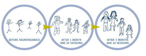 Neurofeedback Training The Neurodevelopment Center
