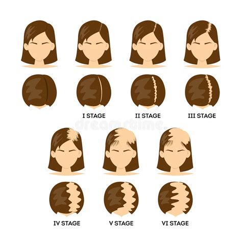 Female Hairless Stock Illustrations – 604 Female Hairless Stock